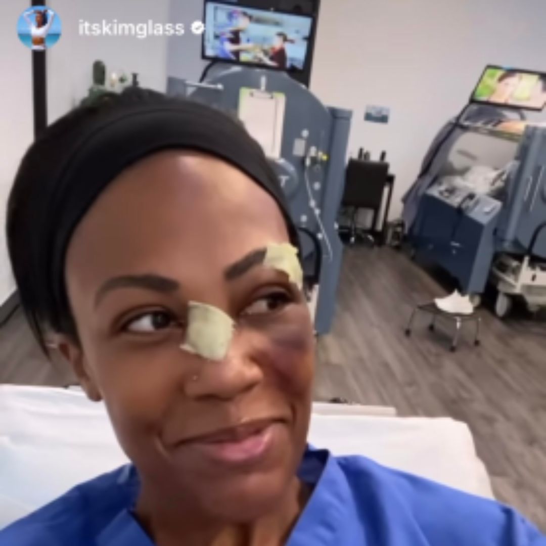 Model & Olympian Kim Glass used HBOT to recover from facial injuries ...