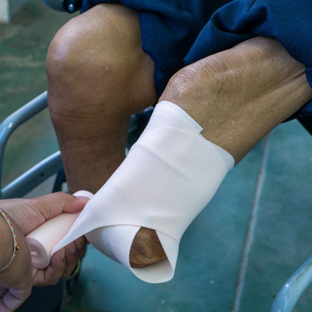 PRESS RELEASE: VETERANS WITH DIABETIC FOOT ULCERS (DFUs) DYING AFTER ...